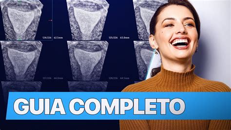 Ultrassom Transvaginal Entenda O Usgtv Como Um Especialista Escola