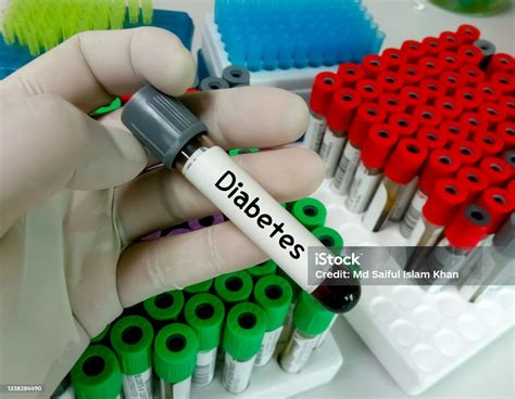 당뇨병 검사 진단 고혈당증 또는 저혈당증을 위한 혈액 샘플 시험관에 대한 스톡 사진 및 기타 이미지 시험관 인슐린 건강 진단 Istock