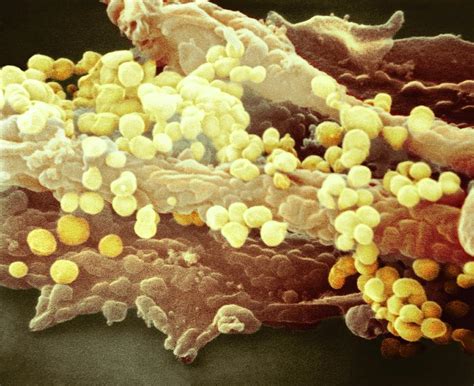 H1n1 Flu Virus Particles Photograph By Nibsc Fine Art America