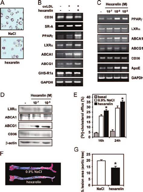 Activation Of The Ppar ␥ Lxr ␣ Abca1 G1 Pathway In Peritoneal Download Scientific Diagram