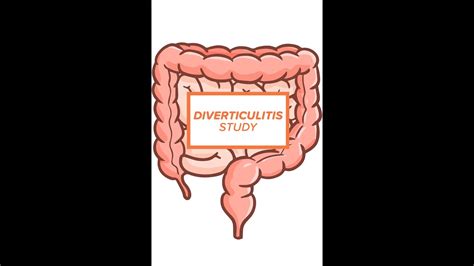 Diverticulitis Study Youtube