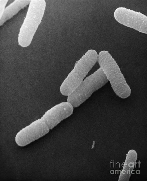 Pseudomonas Aeruginosa Sem Photograph By David M Phillips Fine Art America