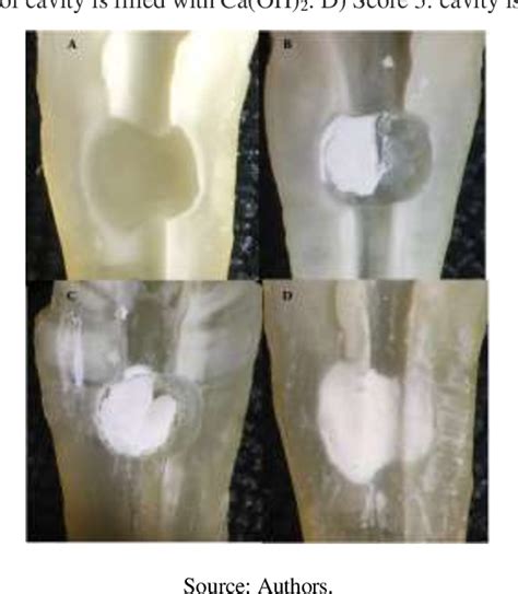 Figure 1 From Evaluation Of The Efficacy Of Xp Endo Finisher Easy Clean Passive Ultrasonic
