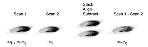 processing scheme of phosphorimaging data in nih image j download