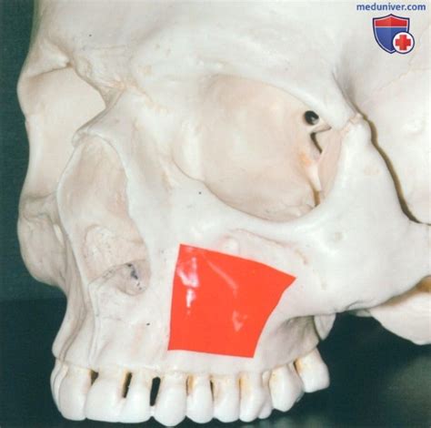 Протокол забора кости со стенки верхнечелюстной пазухи для трансплантации