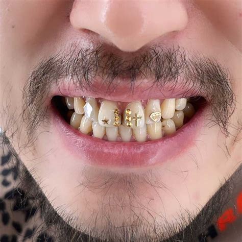 Tooth Gems All You Should Know About Teeth Jewelry