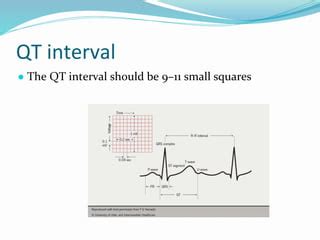 Basic ECG Interpretation For Nurses Leonard Pdf