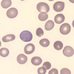 Polychromatic Erythrocyte CellWiki