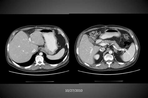 Radiology Basics Pptx Radiology Basics Pptx