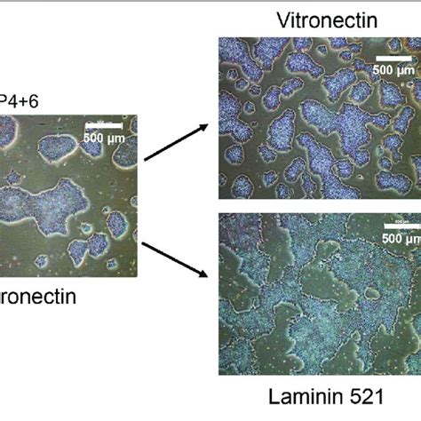 The Morphology Of Ipsc Colonies At Early And Late Passage Number The
