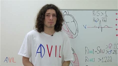 გულის საკნების ცვლილებების დიაგნოსტიკა ეკგ ზე Youtube