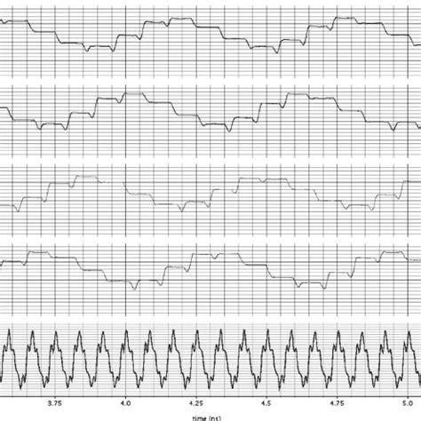 Different Types Of Dac Waveforms A Non Return To Zero Nrz Dac B Download Scientific