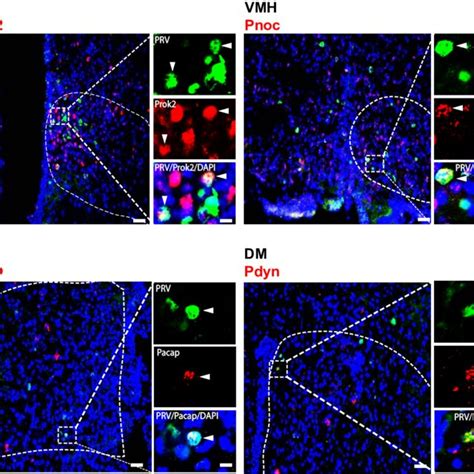Expression Of Individual Neuropeptides In Single Prv Cells Download Scientific Diagram