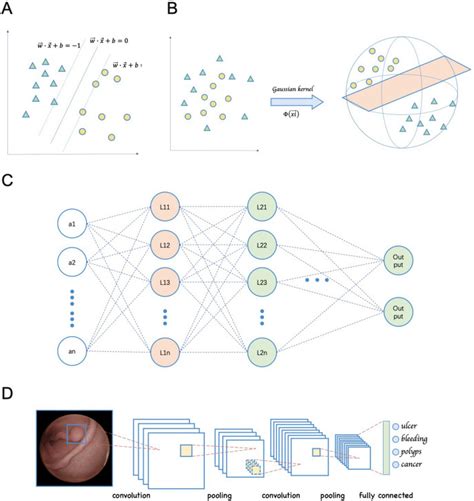 Convolution Neural Network For The Diagnosis Of Wireless Capsule