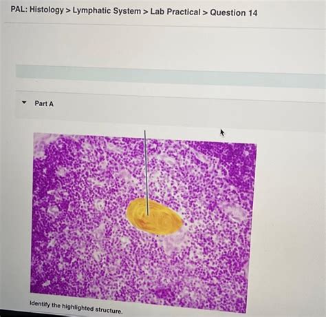 Solved Pal Histology Lymphatic System Lab Practical