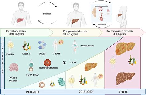 Natural History Of Cirrhosis Compensated And Decompensated14 After Of