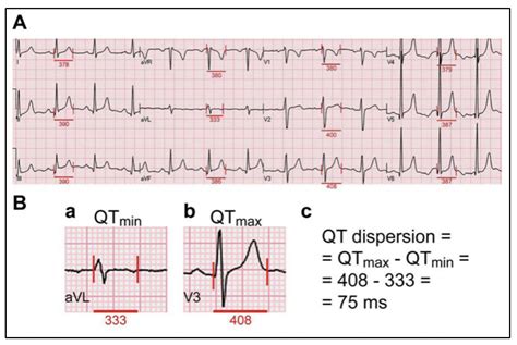 Emergency Medicine Educationqt Dispersion Emergency Medicine Education