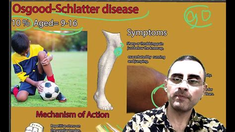 შლატერის დაავადება სიმპტომები მიზეზები მკურნალობა Youtube