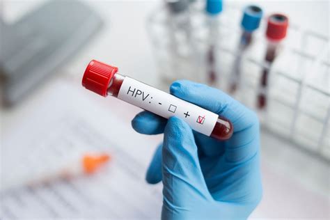 Hpv Screening Package