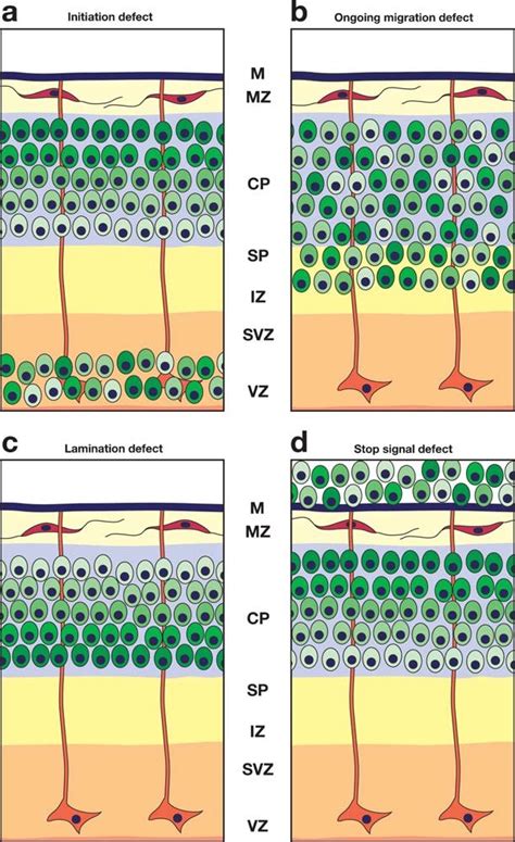 Phenotypes Of Various Cortical Migration Defects M Meninges Mz Download Scientific Diagram