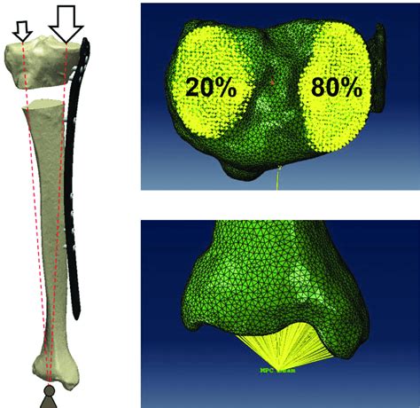 Loading Conditions Mimicking Physiological Activity With Load Sharing Download Scientific
