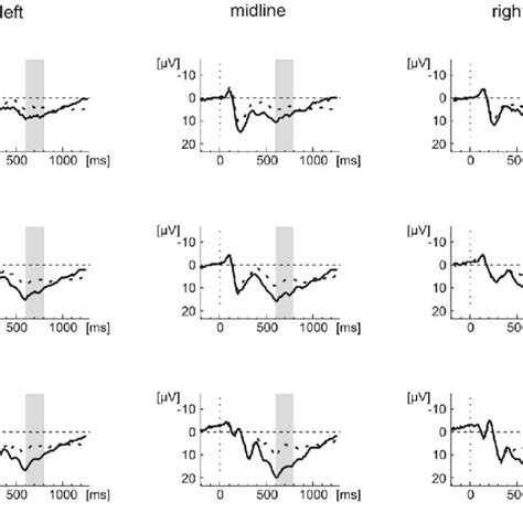 Girls Erps As A Function Of Orientation Stimulus Presentation Was At
