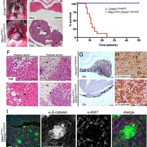 Nuclear Accumulation Of β Catenin And Activation Of The Wnt Pathway