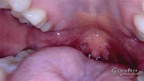 Giantess Yellow Ball Reverse Endoscope Mouth Tour 3