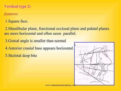 Angles Class2 Div2 Malocclusion Management Ppt
