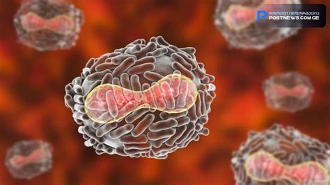 სიმპტომები რომლებიც „მაიმუნის ყვავილს“ ახასიათებს