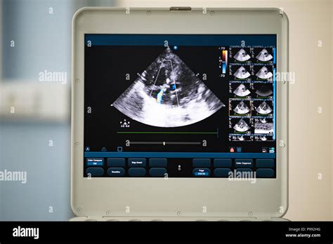 Echocardiogram Procedure Hi Res Stock Photography And Images Alamy