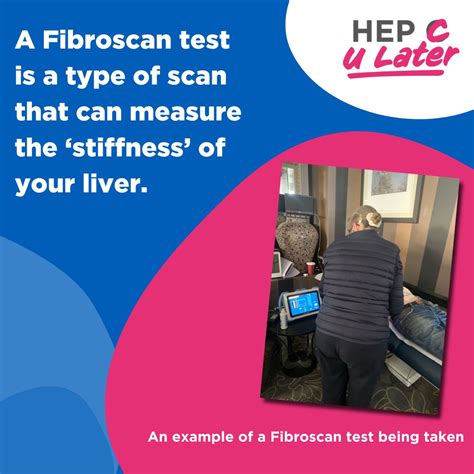 Hep C U Later On Linkedin Ever Wondered How A Fibroscan Checks Your Liver We Have Put Together