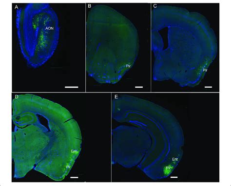 A E Representative Pictures Showing The Retrograde Labeling Download Scientific Diagram