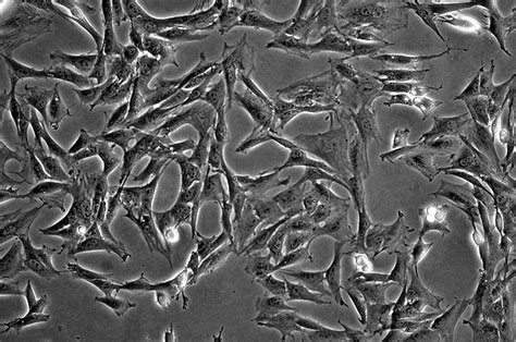 用于分离多物种脂肪干细胞的试剂盒及其使用方法和应用与流程 3