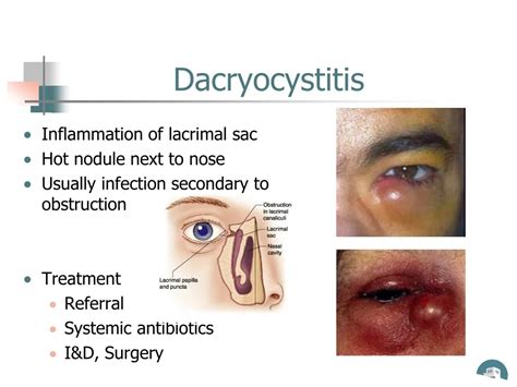 Ppt Ophthalmology For Primary Care Providers Powerpoint Presentation
