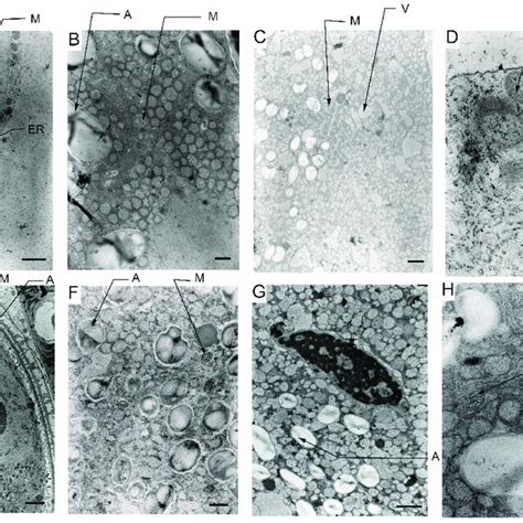 Tem Micrographs Of Pollen Grains Collected From Lubuski Plants Grown