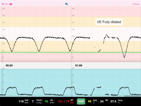 Monitor Mode Overview ISimulate