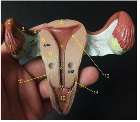 Chapter 26 Part 3 Diagram Quizlet