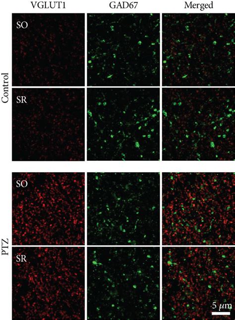 Distribution Of Vglut1 Positive And Gad67 Positive Puncta In The