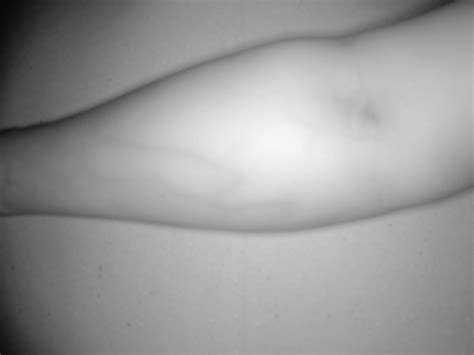 Dr Ravimal Bandara A Fast Simple And Powerful Contrast Enhancement