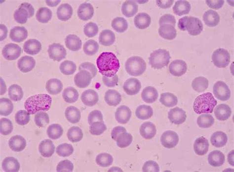 Plasmodium Vivax Learnaboutworld