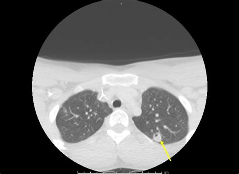 Chest Computed Tomography With Contrast Download Scientific Diagram