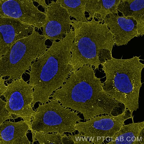 Flexable Biotin Antibody Labeling Kit For Mouse Igg1 Kfa027 Proteintech
