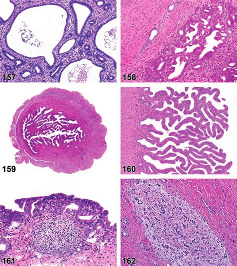 Cystic Glandular Hyperplasia Uterus Rat Figure 158 Hyperplasia