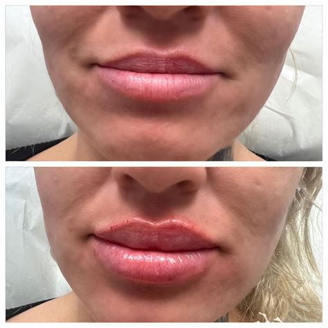 Fountain Of Youth Anti Aging Facial Hello Gorgeous Medical Spa