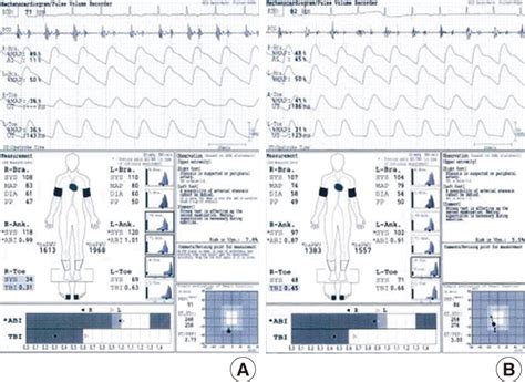 Cases 5 6 A Initial Toe Brachial Index Tbi Values The Right And