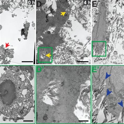 Transmission Electron Microscopy Suggests Ecm Fiber Endocytosis Download Scientific Diagram