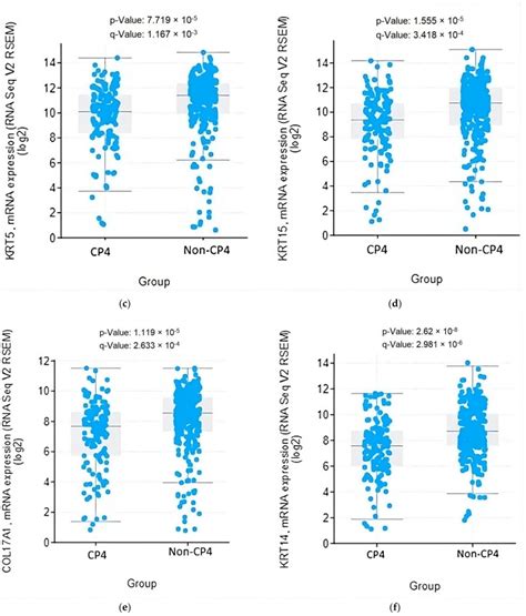 Prognostic Significance Of The Cribriform Pattern In Prostate Cancer