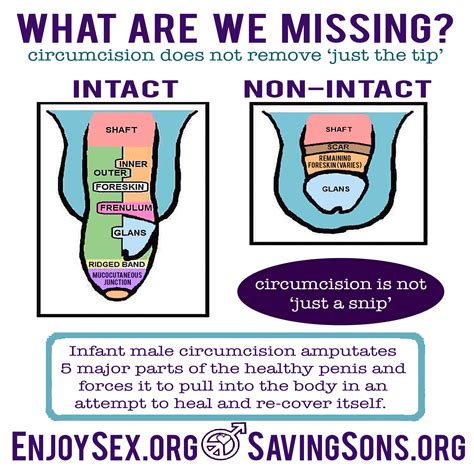 Full Circumcision