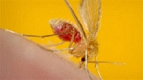 Cutaneous Leishmaniasis